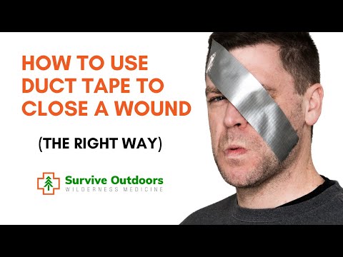 Wound Closure in the Outdoors using Duct Tape and Staples