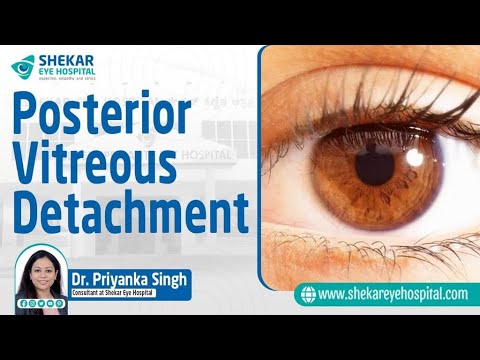 What is Posterior Vitreous Detachment? What are its symptoms? | Shekar Eye Hospital