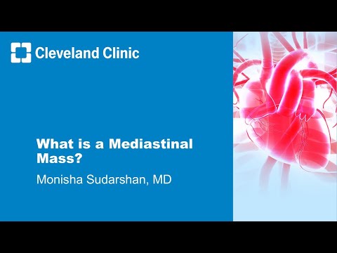 What is a Mediastinal Mass?