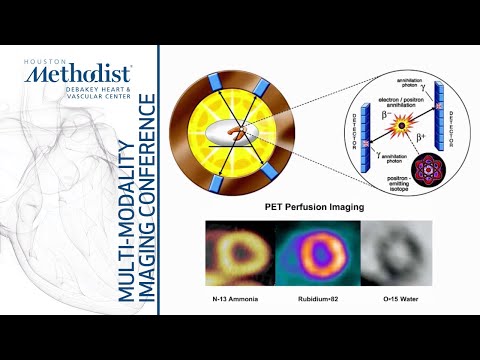 Stress SPECT and PET: Methodology and Case Studies (F. Nabi, MD, M. Al-Mallah, MD) February 15, 2022