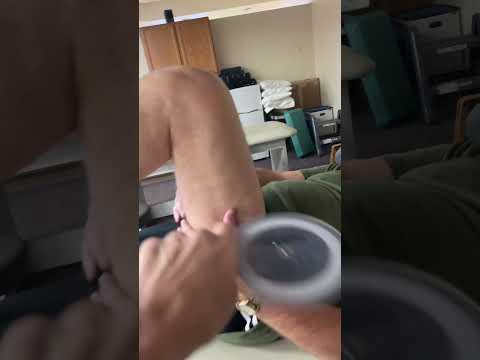 Knee Flexion ROM #partialkneereplacement