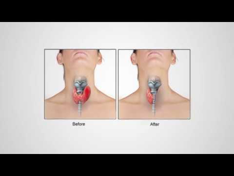 How to prevent cancer? | Surgical Oncologist in Bangalore - Dr. G Girish | Aster CMI Hospital.