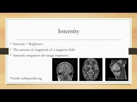 Intensity, Hypointensity, Isointensity, and Hyperintensity in MRI by Habibur Rahman