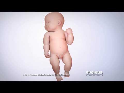 What is Orchiopexy at Cook Children's?