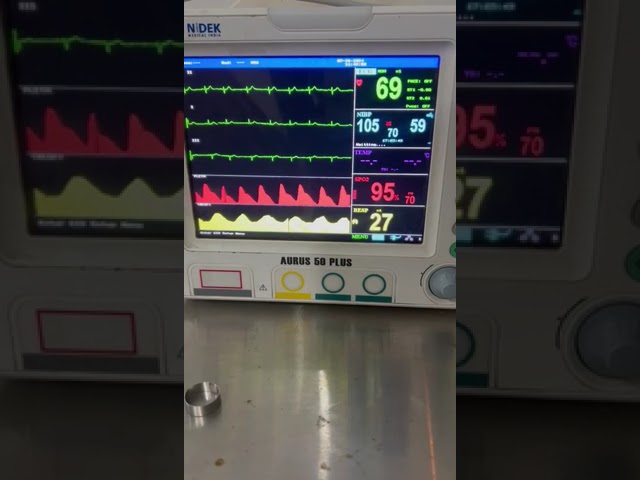 Cardiac & Multi-parameter Patient Monitor - 3 Para Patient Monitor ...