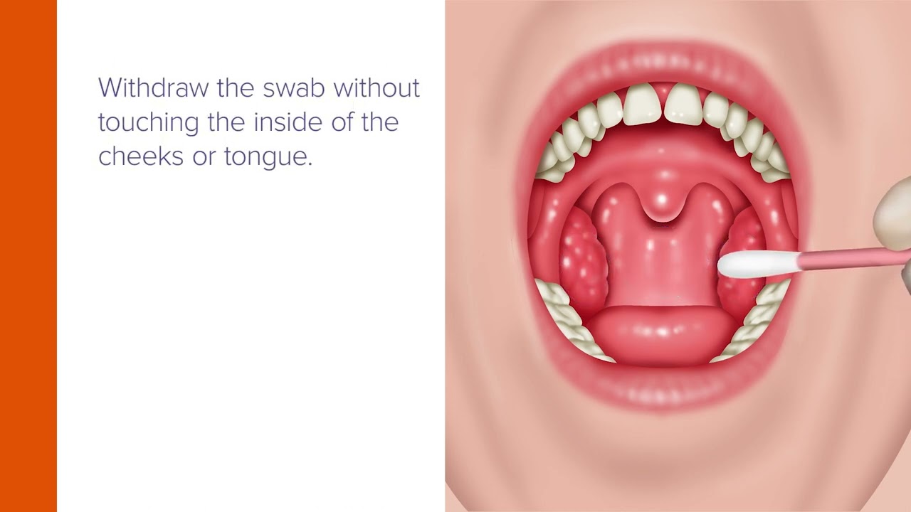 Aptima® Multitest Swab - Clinician-Collected Throat Specimen Collection Guide