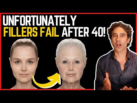 WHY FILLERS STOP WORKING At 40 💉 // How to Look Younger Than Your FRIENDS