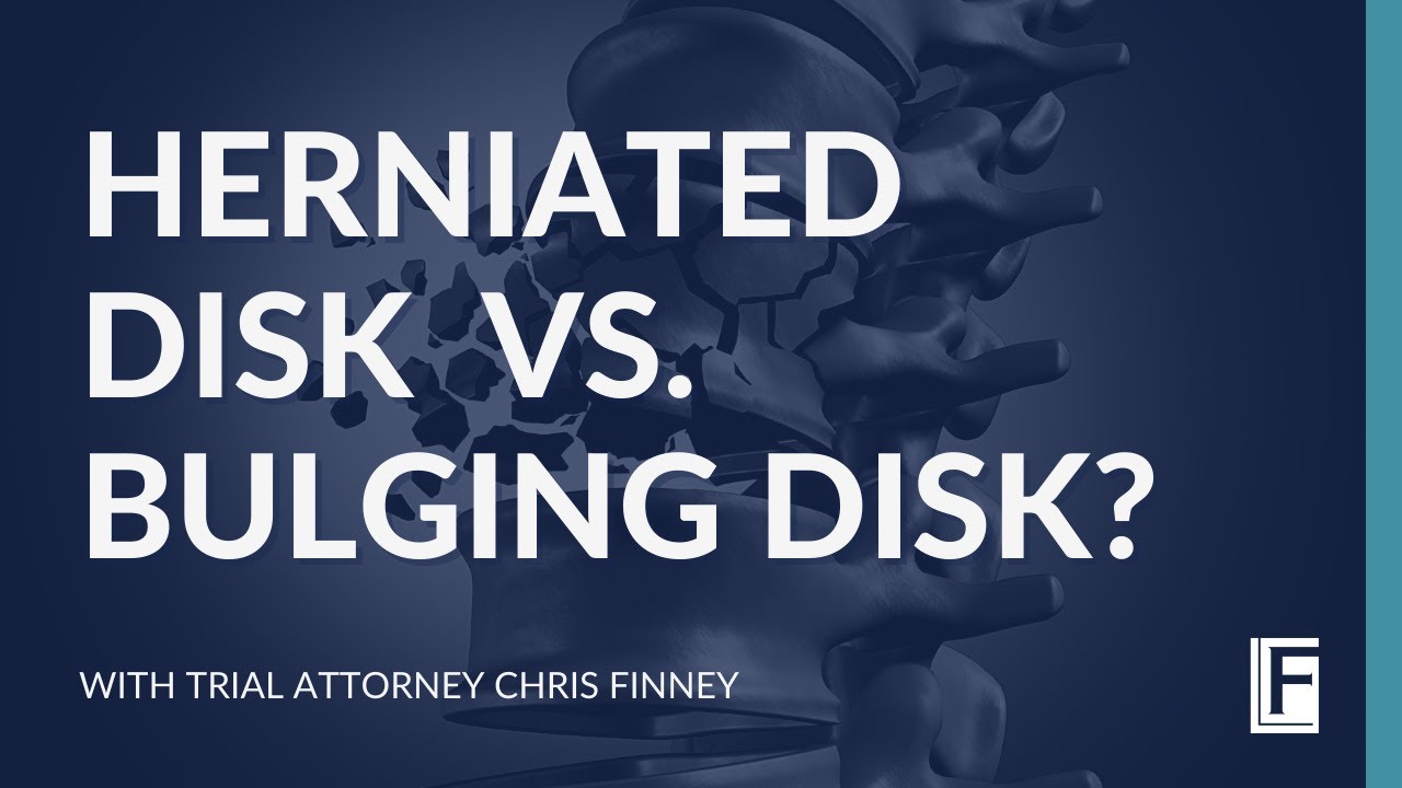 What’s the Difference between a Herniated Disk and a Bulging Disk? | St ...