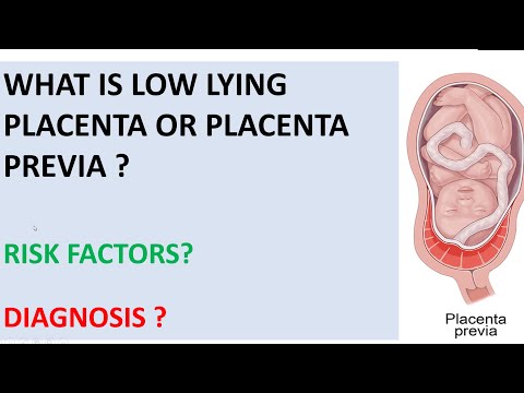 what is low lying placenta and placenta previa|why it happens|how to diagnose placental localization