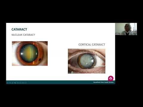 Security Health Plan Academy: Vision and eye care as we age