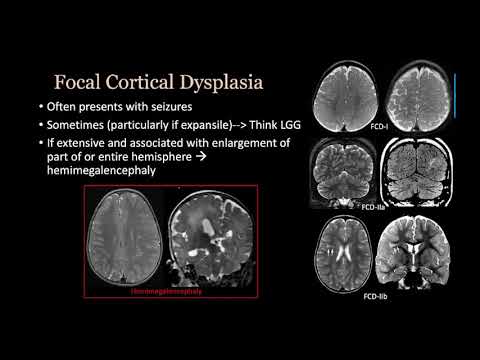 imaging Congenital malformation Brain and spine