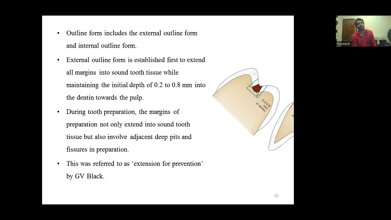 PEDIATRIC OPERATIVE DENTISTRY | Dr RAMNESH | DEPARTMENT OF PEDODONTICS |