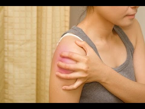 Settling a Workers Compensation Shoulder Injury