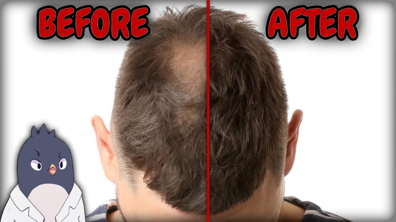 Special Vitamin E Helps Regrow 34% More Hair?
