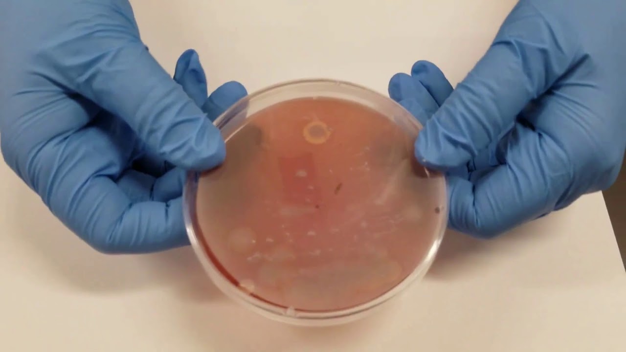 Microbiology of Soil