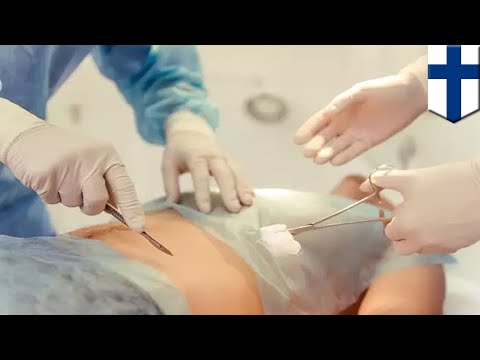 Antibiotics could treat appendicitis, instead of surgery - TomoNews