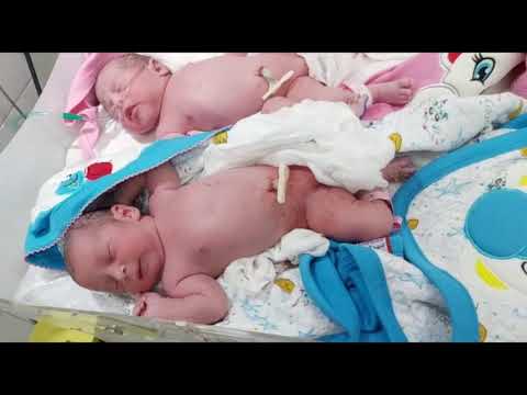 what's twin-twin transfusion syndrome? monochoronic, discordant twin ( different weight & Hb levels)