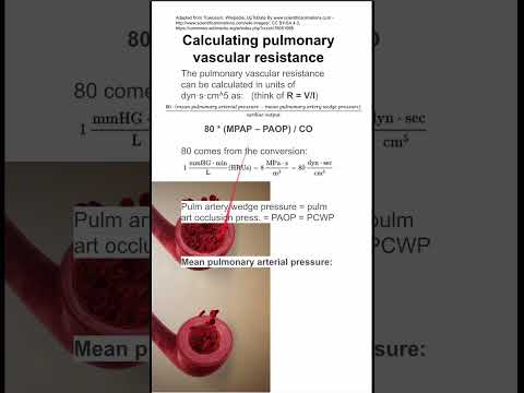 Calculating pulmonary vascular resistance