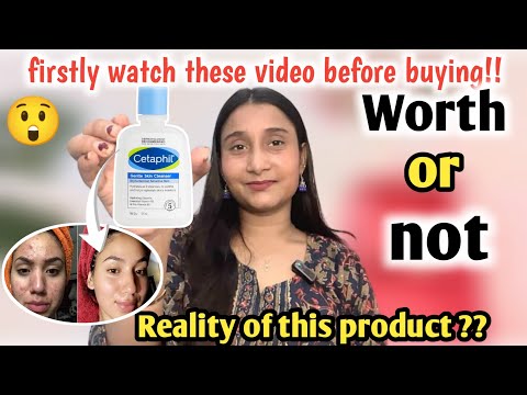 Cetaphil Gentle Skin Cleanser Remove Dark Spots Honest Result | Cetaphil Cleanser Review #cetaphil