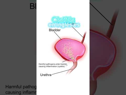 Domina tu Vocabulario: CISTITIS EN INGLÉS | Interpretación Consecutiva Medica de Excelencia
