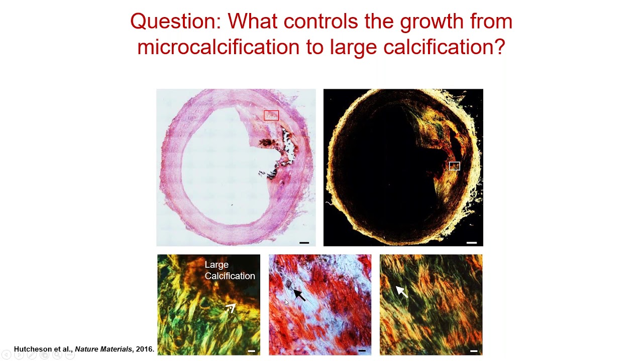 Cardiovascular Mechanics and Extracellular Vesicles