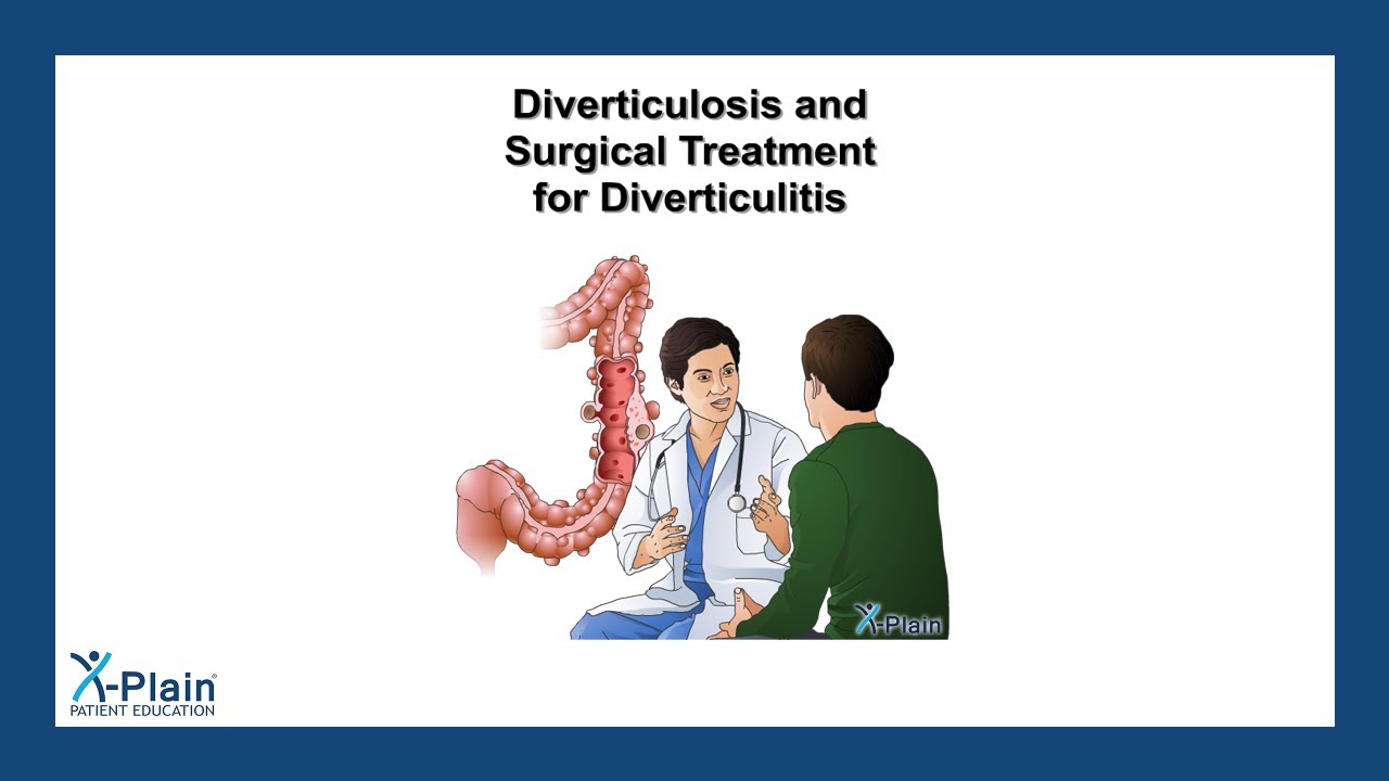 Diverticulosis and Surgical Treatment for Diverticulitis