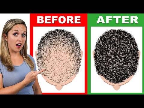 1 Product to Prevent Hair Loss and Regrow Your Hair!