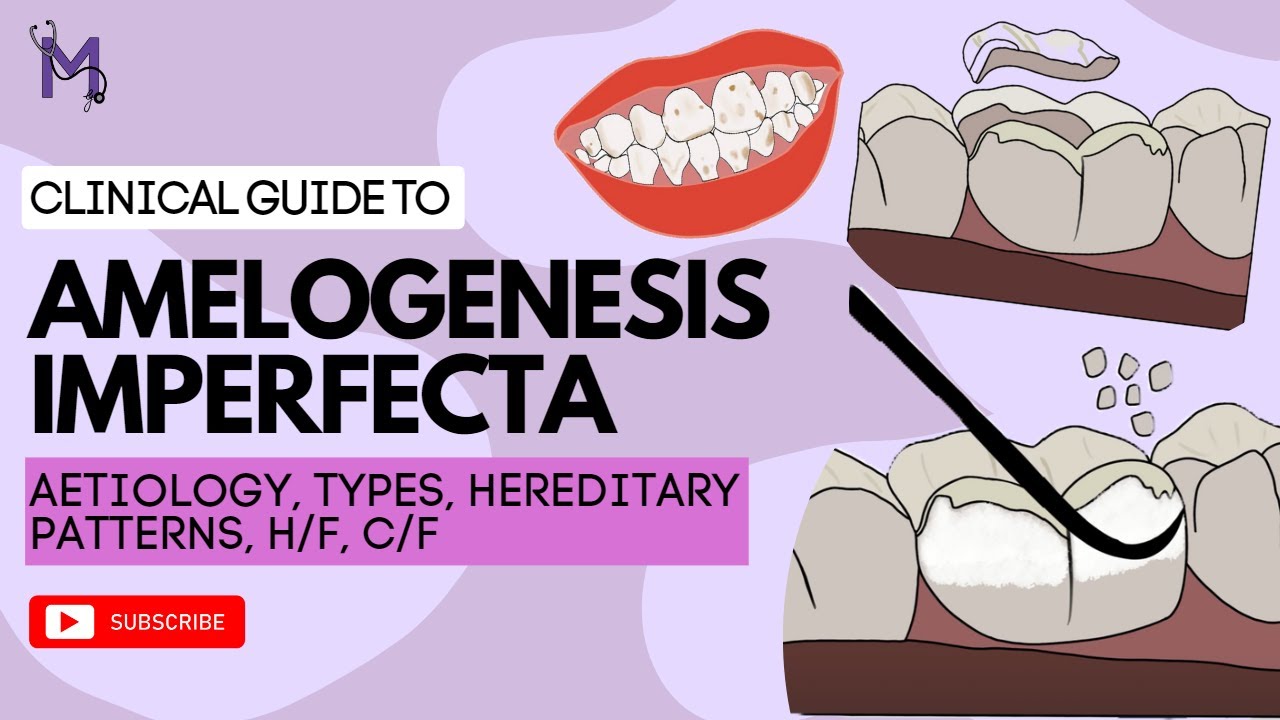 Tooth Development Explained | Amelogenesis Imperfecta, Genetics & Types | Oral Pathology