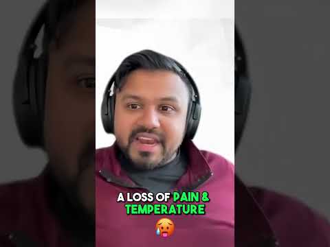 Chiari Malformations for the USMLE | HyGuru