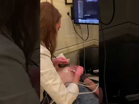 Quick, Painless, Non-Surgical Breast Lump Removal? Here's How It's Done!