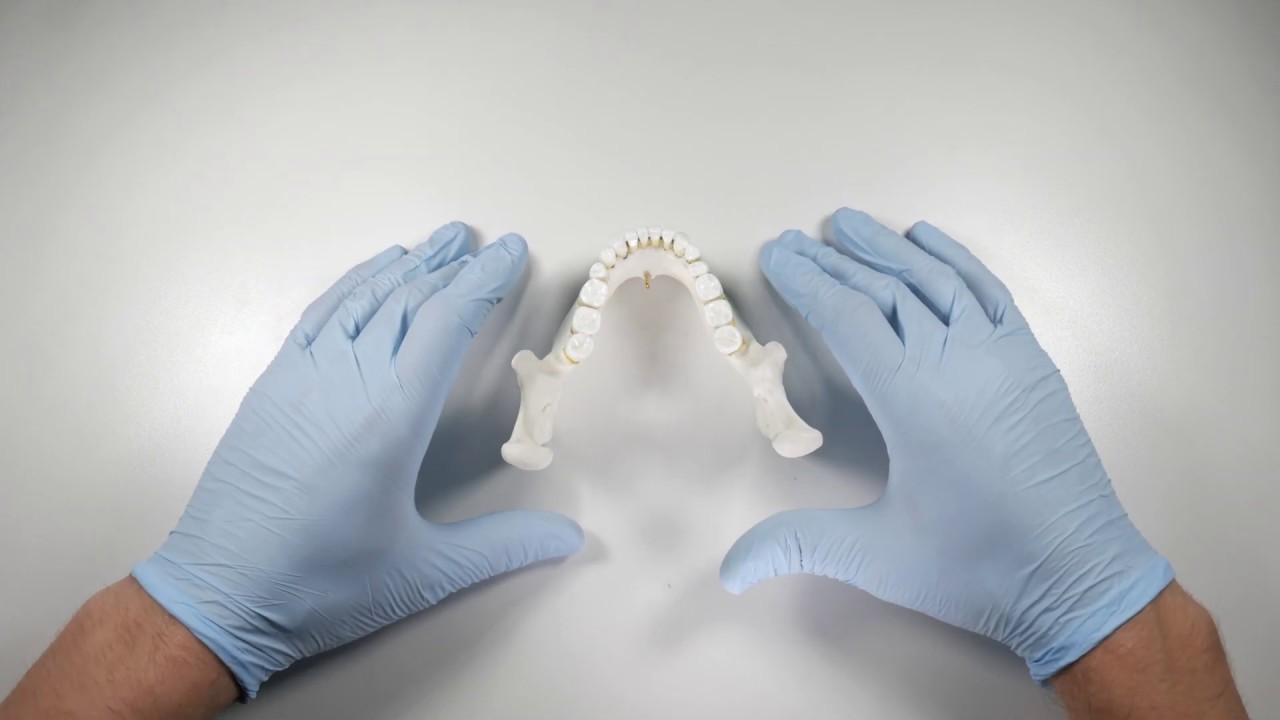 How To Resolve A Bony Mylohyoid Sequestrum | OnlineExodontia.com