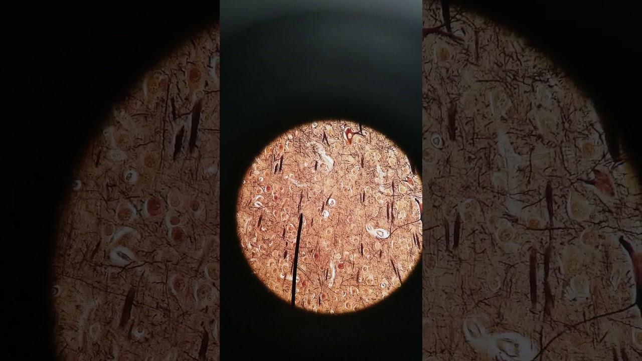 Pyramidal and purkinje cells histology