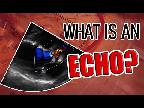 What is an Echocardiogram?
