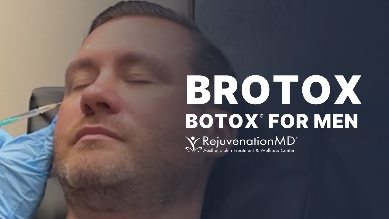 Botox for Men: Treat Crow’s Feet, Glabella, and Forehead