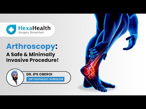 What are risks/potential complications after Arthroscopy Surgery? || HexaHealth Expert