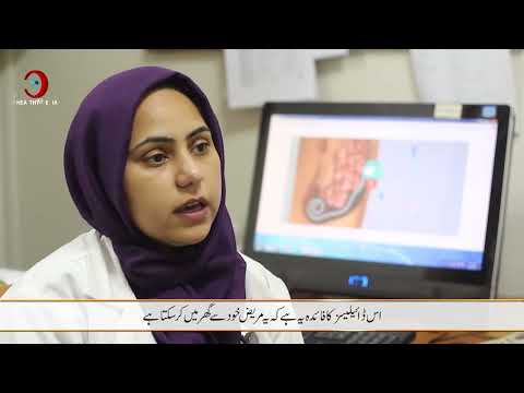 What is Peritoneal Dialysis?