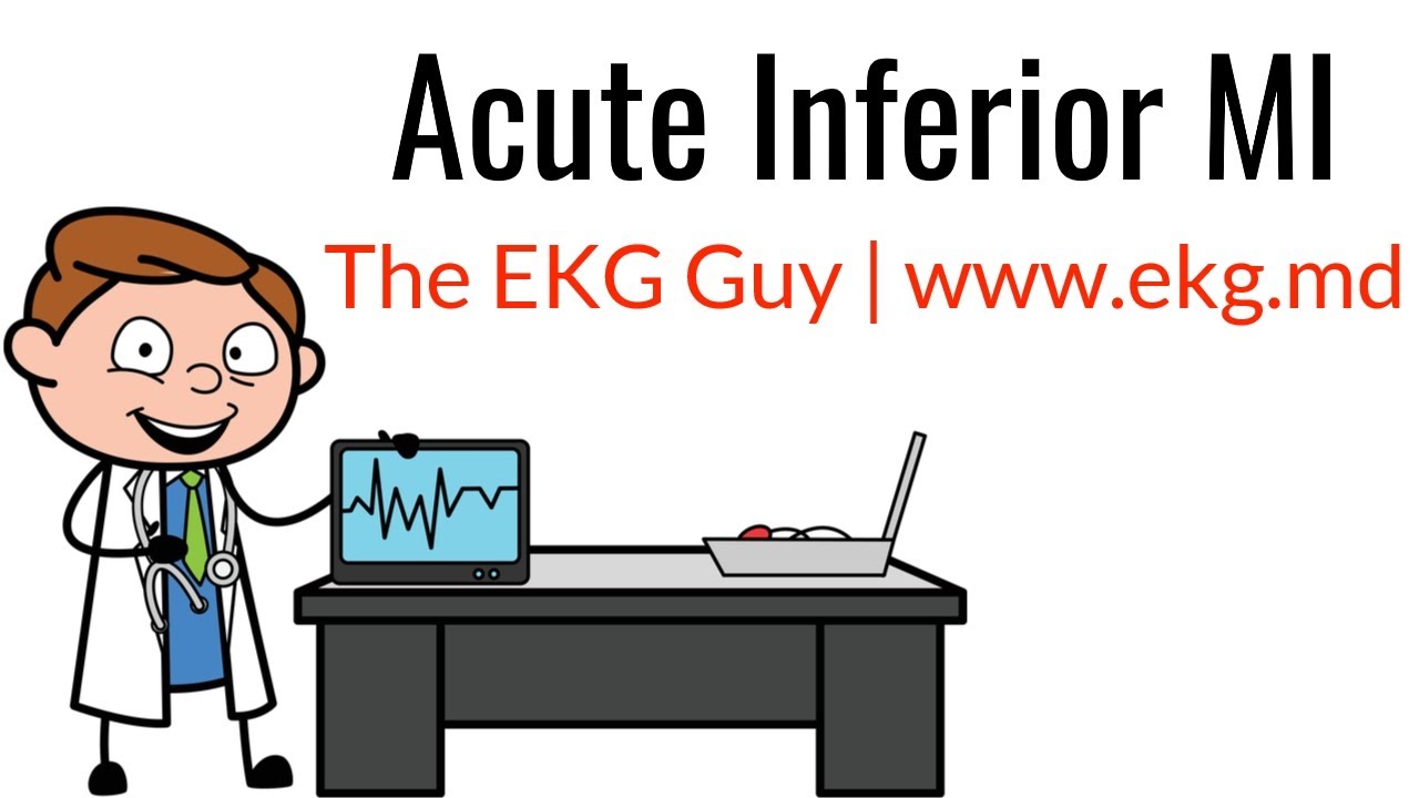 Acute Inferior MI on EKG / ECG l The EKG Guy - www.ekg.md
