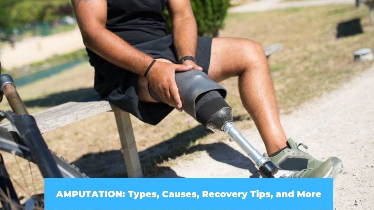 AMPUTATION: Types, Causes, Recovery Tips, and More