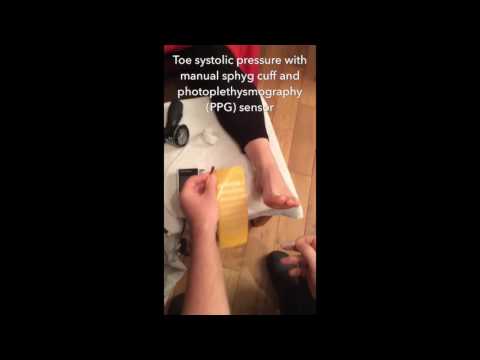 Toe Taking a toe systolic pressure with a sphyg & PPG sensor