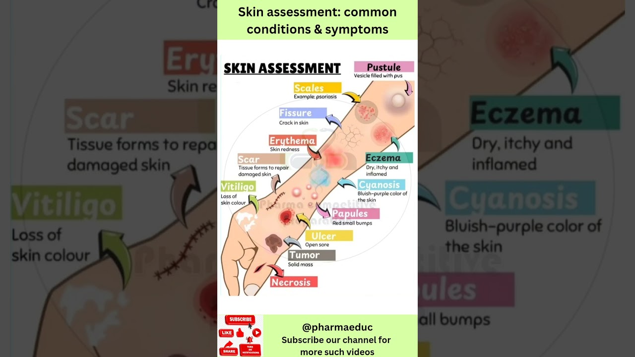 Skin assessment l common skin conditions & their symptoms | Dermatology guide