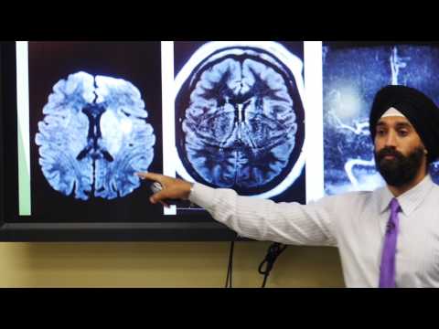Ischemic Stroke - Arun Singh Chhabra, MD