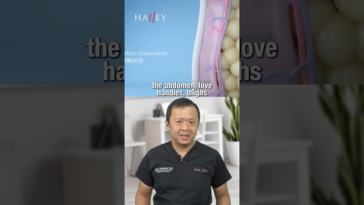 CoolSculpting Fat Reduction Treatment Explained: Remove Up to 27% of Unwanted Body Fat!