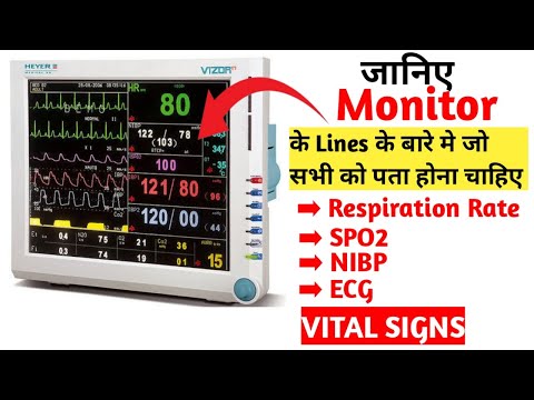 ICU MONITOR READINGS EXPLAINED IN HINDI | VITAL SIGNS | आईसीयू मोनिटर मे किया किया देखा जाता हैं