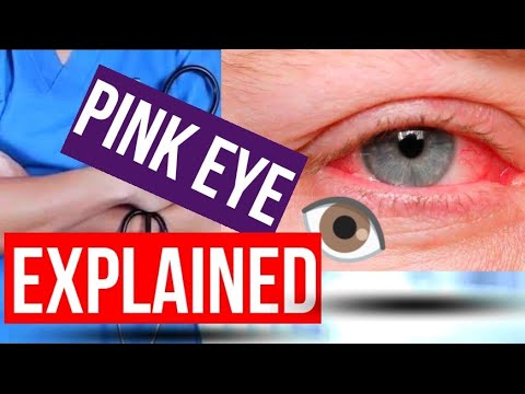 How to simply diagnose ,treat and prevent Bacterial conjunctivitis
