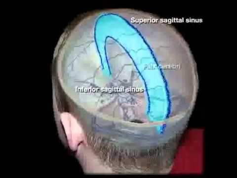 Dural Venous Sinuses - Neurology - Medbullets Step 1
