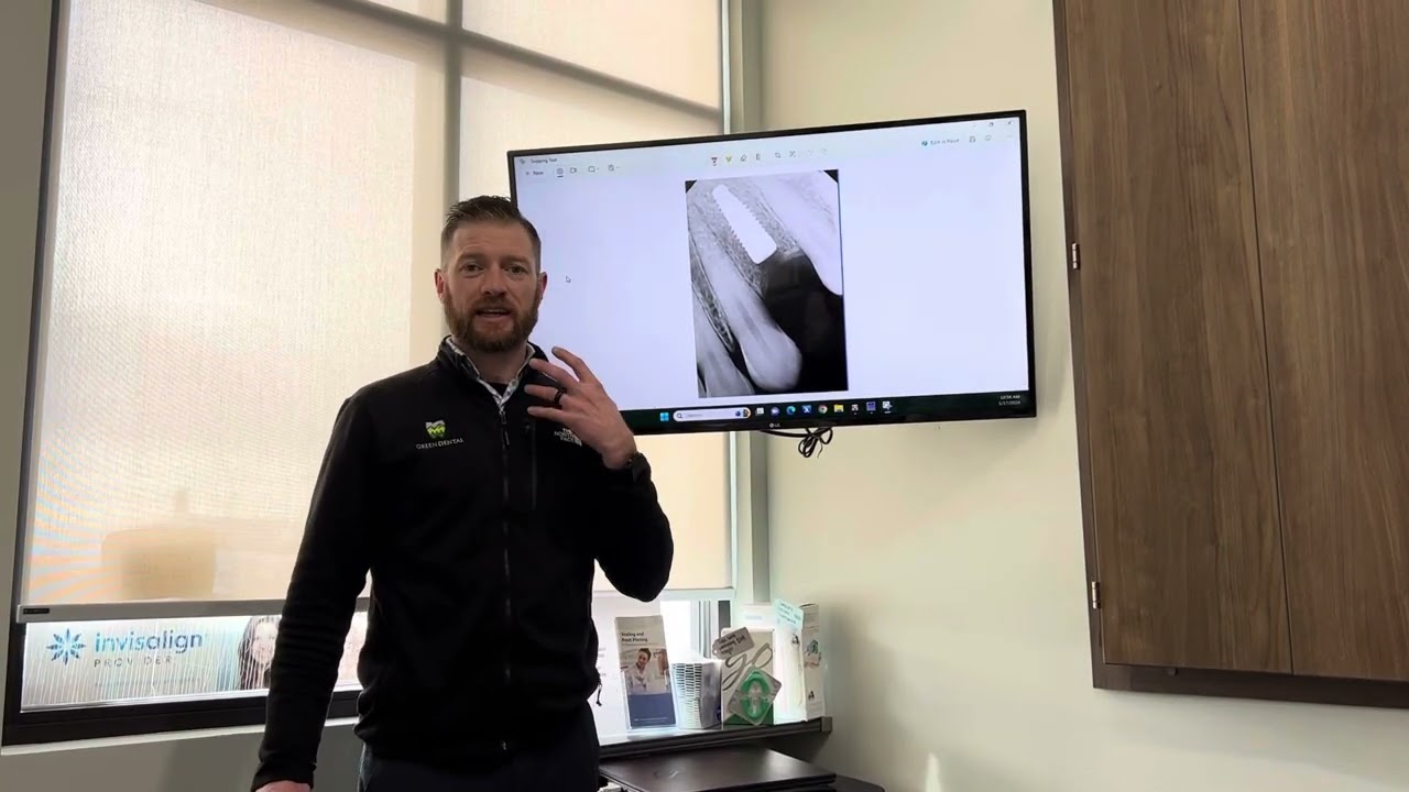 Dental Implant Post-Op Instructions | Dr. Chris Green, Parker CO | Green Dental Care