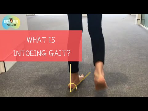 intoeing gait and orthotics therapy