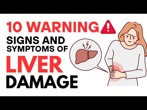 10 Warning Signs Of Liver Damage, Liver Disease Symptoms, Early Signs Of Liver Failure & Problems