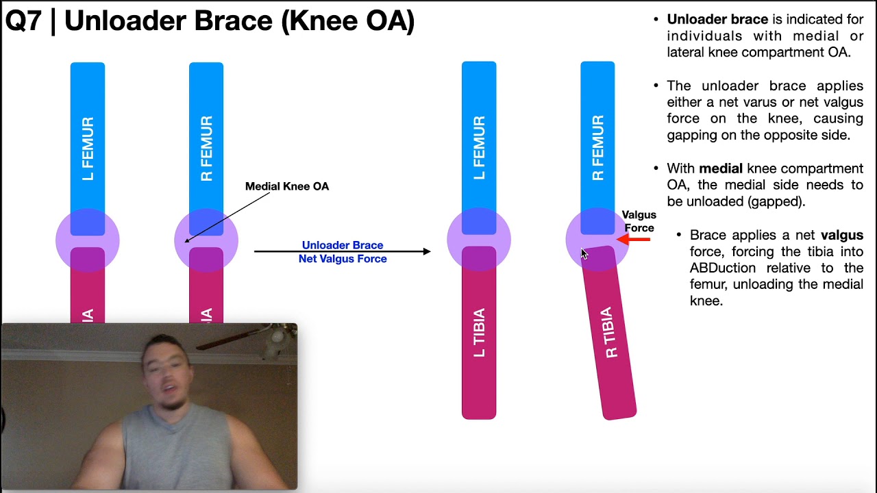 The Unloader Brace for Knee OA | How Does It Work?