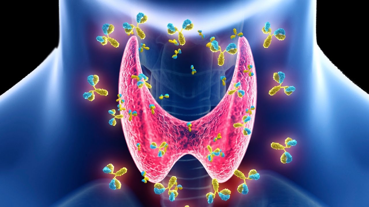 Hyperthyroidism:  The complete guide